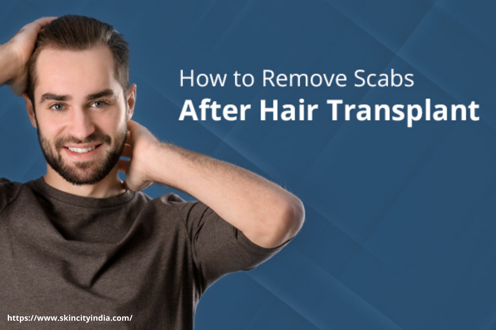 How to get rid of scabs after a hair transplant? - Hair N Images